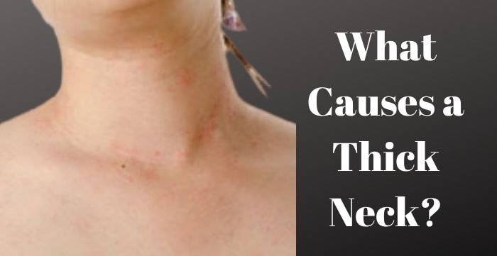 What Causes a Thick Neck: Understanding the Causes