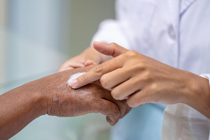 Common Types of Autoimmune Diseases And Treatment Options
