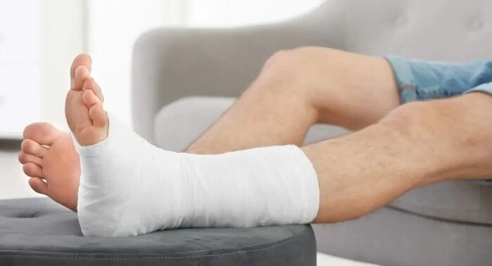 How To Exercise With A Broken Ankle - 8 Upper Body Workouts